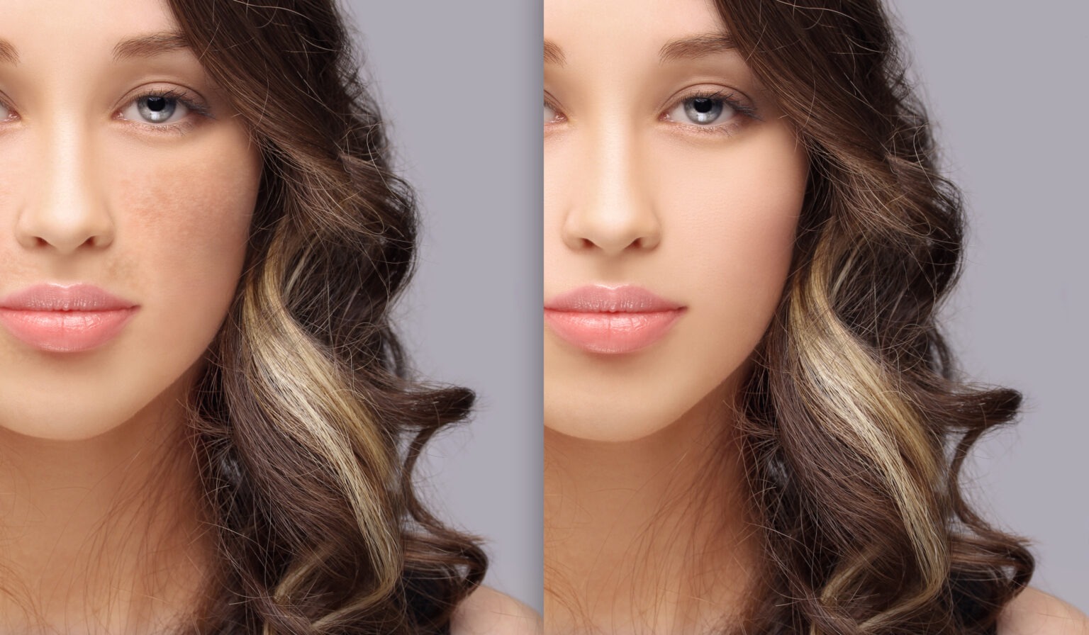 Why Moisturizers Stop Working in Winter | Skin Barrier Care